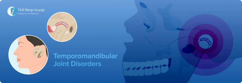 TMJ Disorders: Meaning, Symptoms, Causes & Treatment